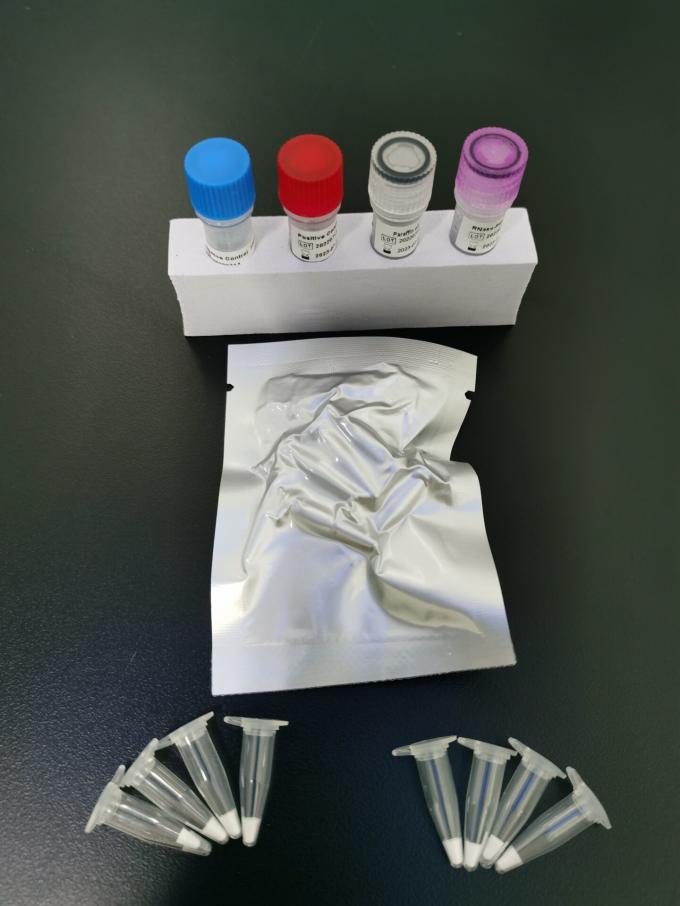 Detección en tiempo real Kit Lyophilized de la polimerización en cadena ...